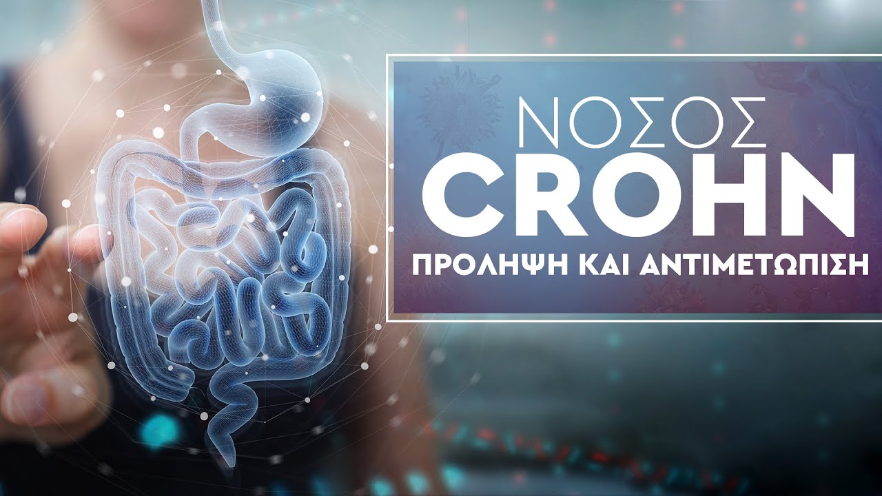 Νόσος Crohn | Πρόληψη και Αντιμετώπιση - YouTube