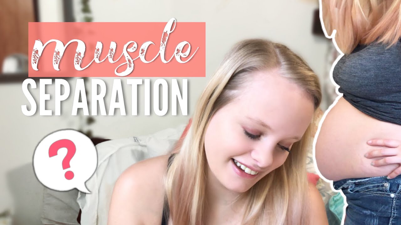 13-14 Weeks | Muscle Separation & Bump | Pregnancy Update | Mess of a ...