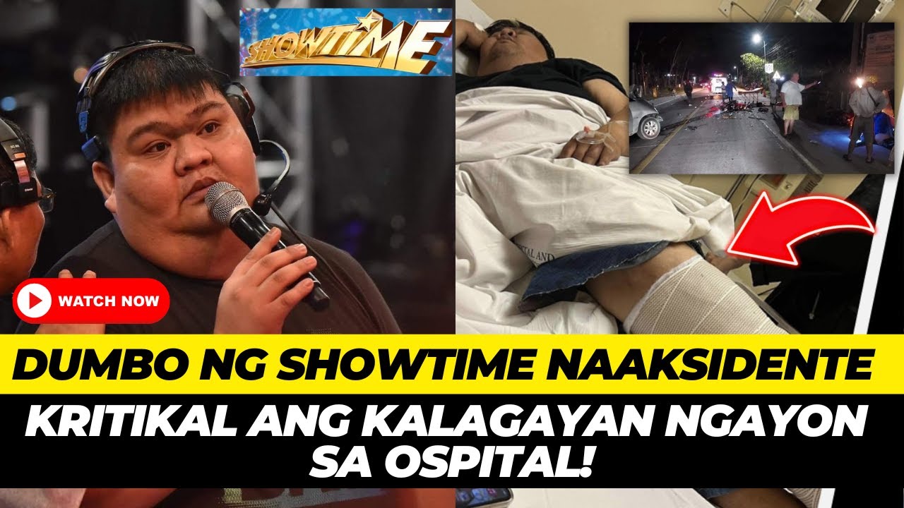 DUMBO NG ITS SHOWTIME NAAKSIDENTE! MALUBHA ANG KALAGAYAN NGAYON SA OSPITAL! - YouTube