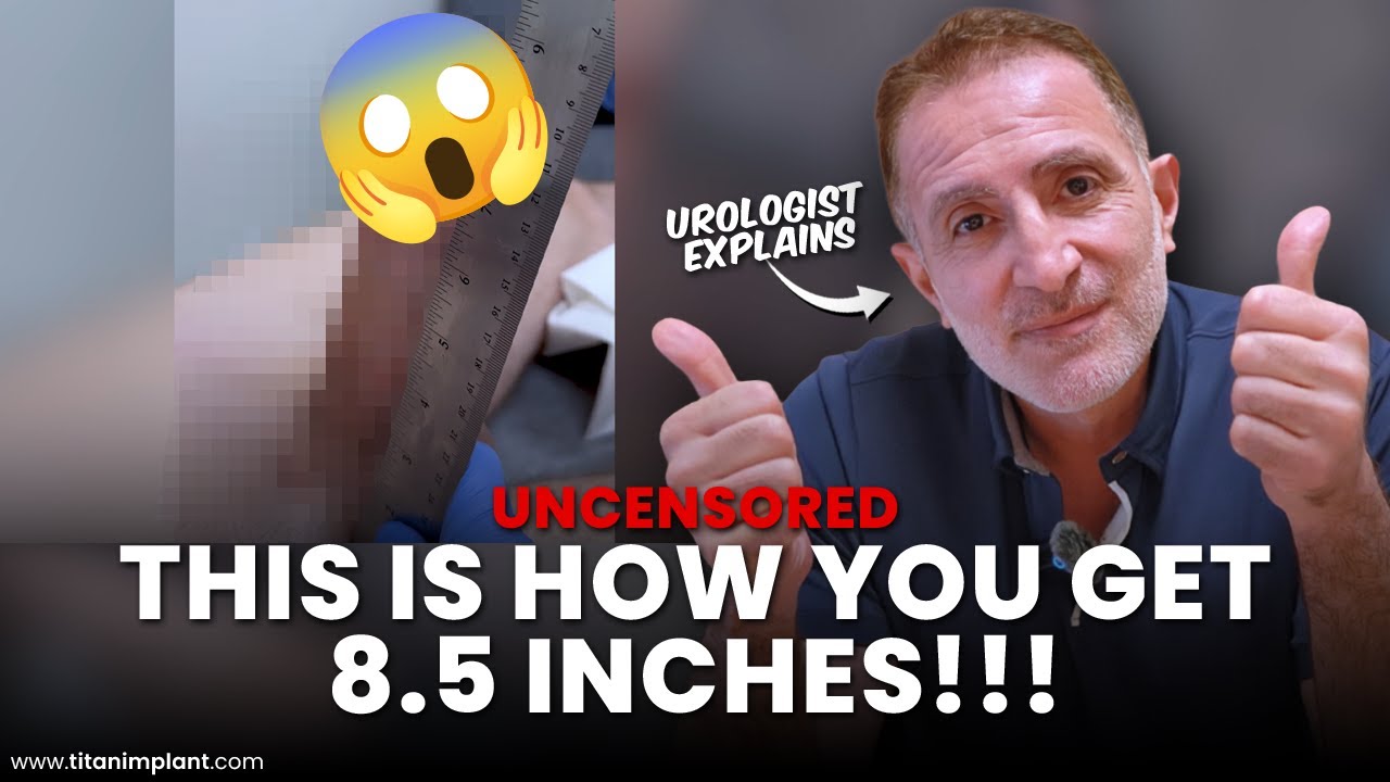 How He Got 8.5 INCHES with IPP!!! | Real Patient’s Testimonial & Post ...