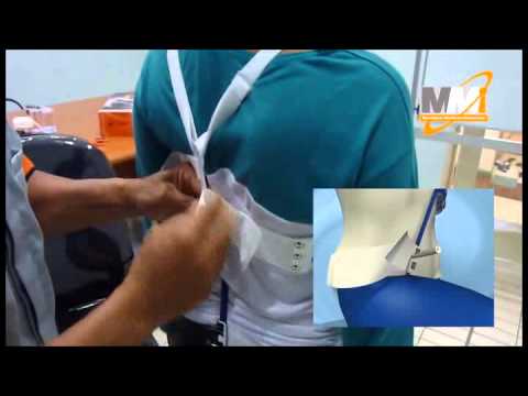 Step by step fiting TriaC Brace - YouTube