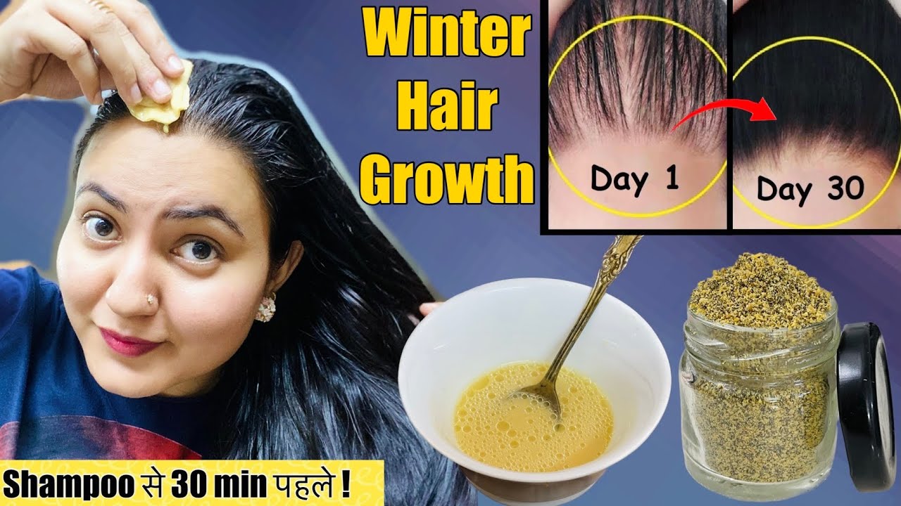 30 Days *Winter Hair Growth* Challenge : Regrow Lost hair, Fix Bald ...