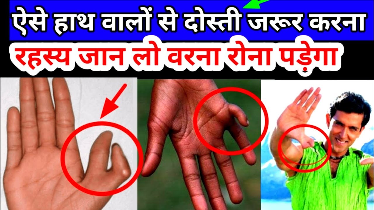 जानिए कैसे होते हैं 6 ऊंगली वाले लोग ? | Six Fingers Astrology in Hindi 6 ungli wale log kaise ...