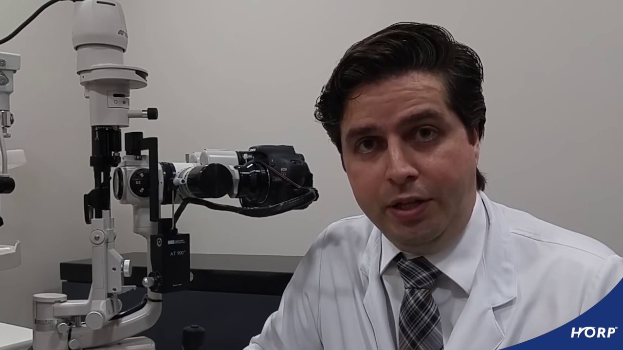 Pressão intraocular ideal e o exame de Tonometria - YouTube