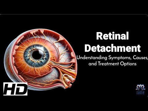 Inside the Eye: Anatomy and Risks of Retinal Detachment - YouTube