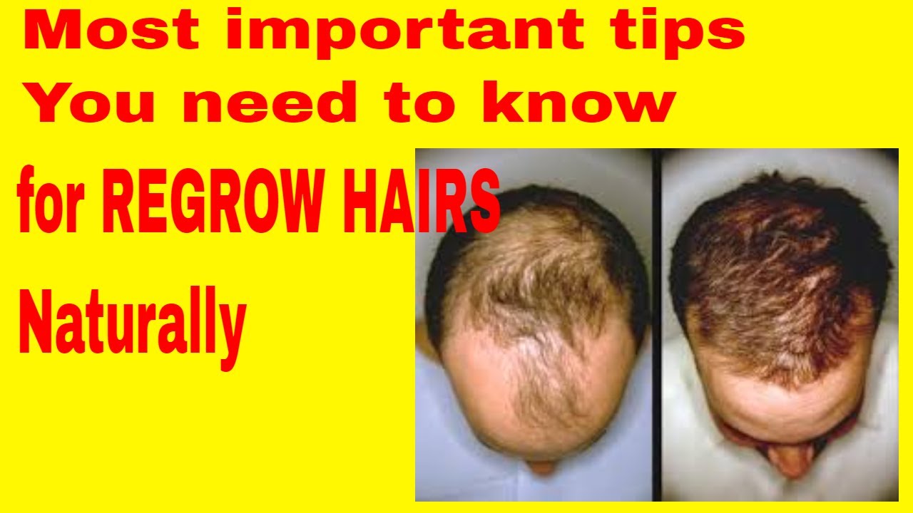 Most important tips for Regrow hairs Naturally | how to regrow hairs ...