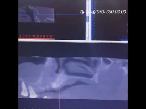 Dr Vasif Bagirov(070) 350 03 03