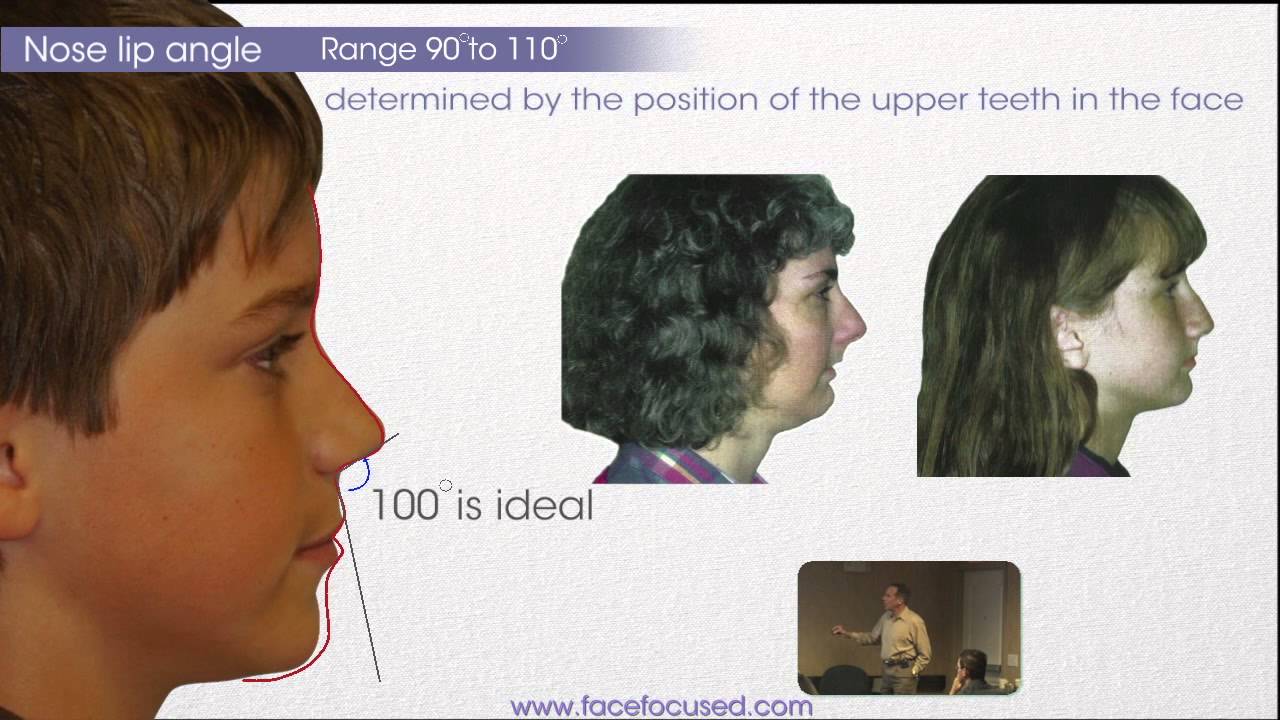 The Case for The Nose - Lip Angle - William M. Hang DDS MSD - YouTube
