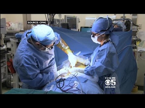 6-Way Kidney Swap Underway At California Pacific Medical Center - YouTube