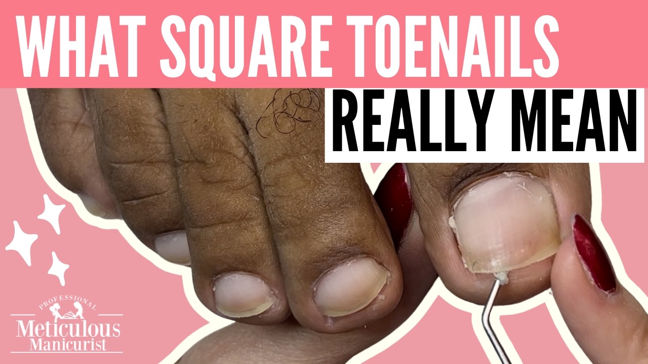 Why No Square Toenails & Diabetic Foot Care | Real Talk, Real Results ...