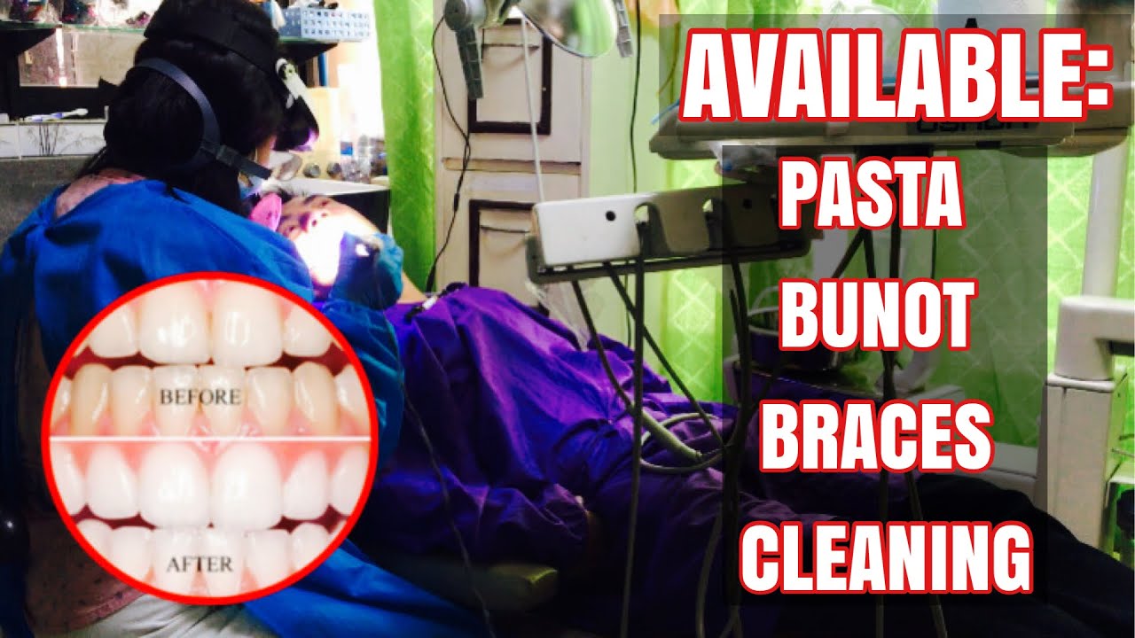 Dental Clinic Appointment | Tooth cleaning (pasta) #tooth # ...