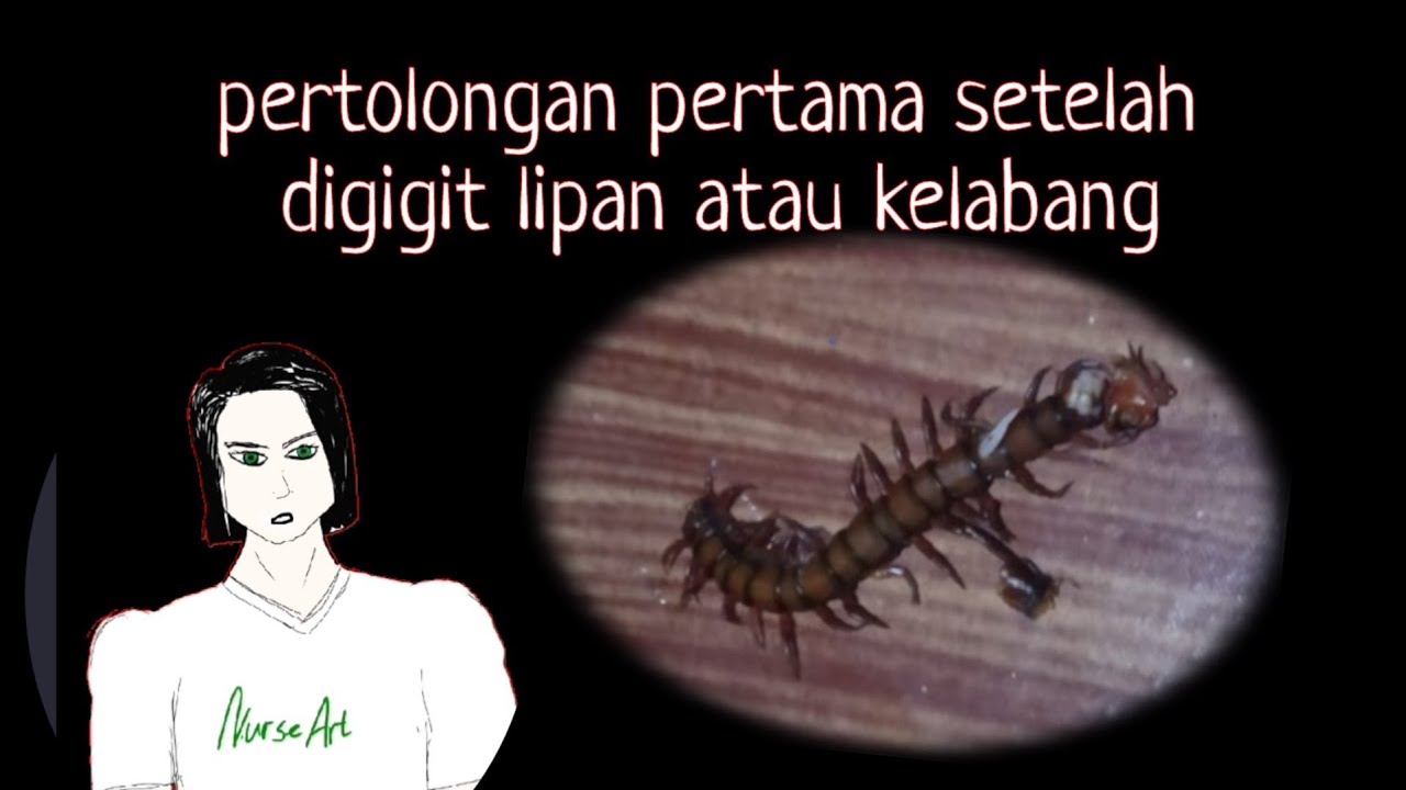 Penanganan setelah digigit lipan, kelabang, was bitten by a centipede ...