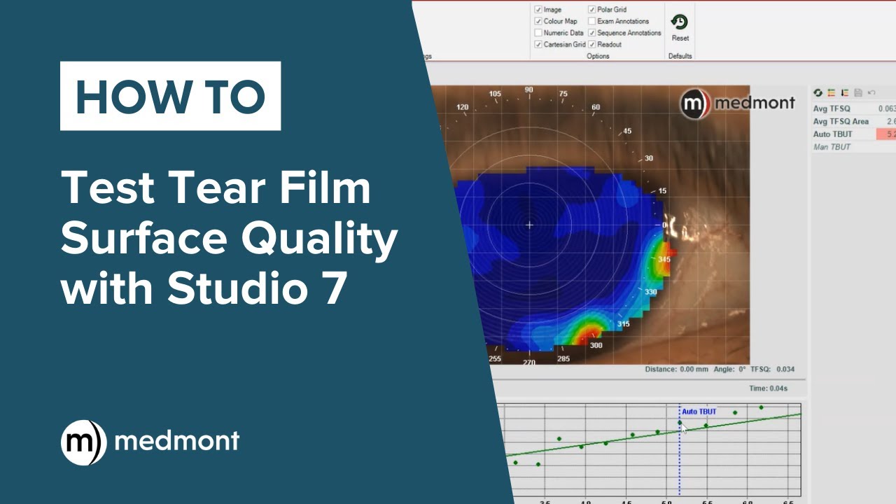 How-To | Use the Tear Film Surface Quality feature (Studio 7) - YouTube