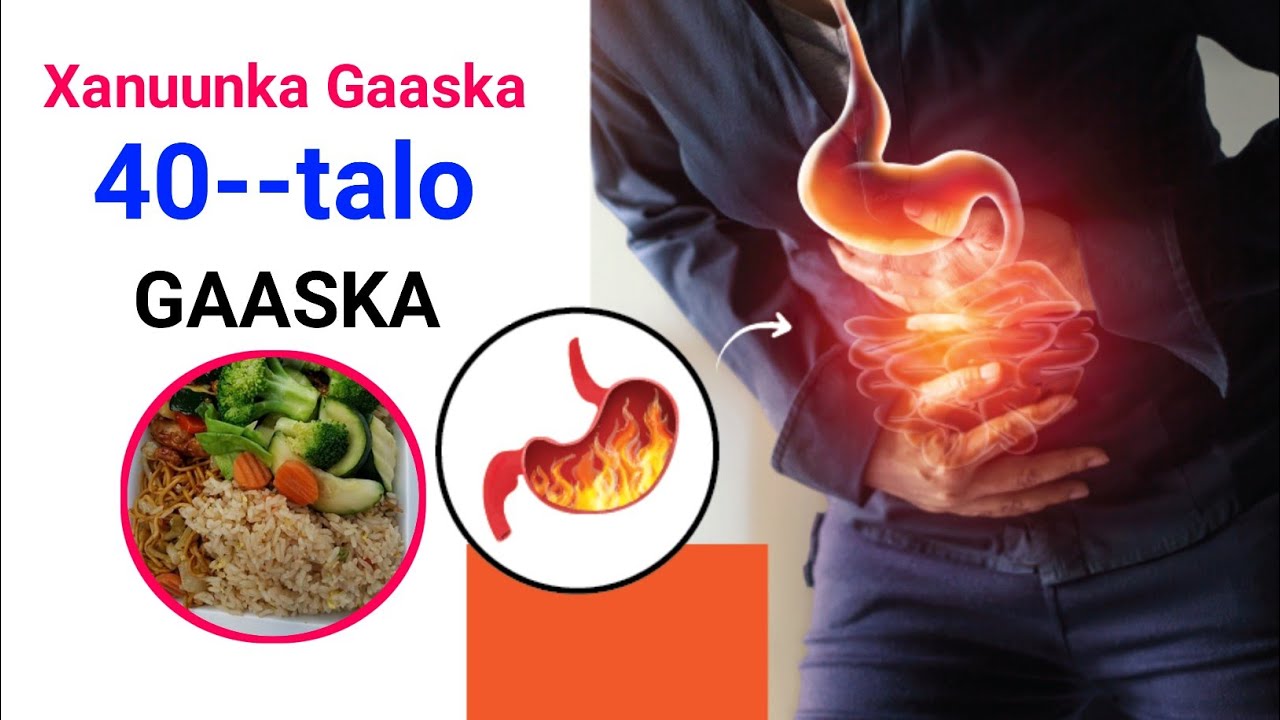 xanuunka Gaaska 40 talo oo dadka qabo anfaceeysa sameey 40-kaan Sheey ...