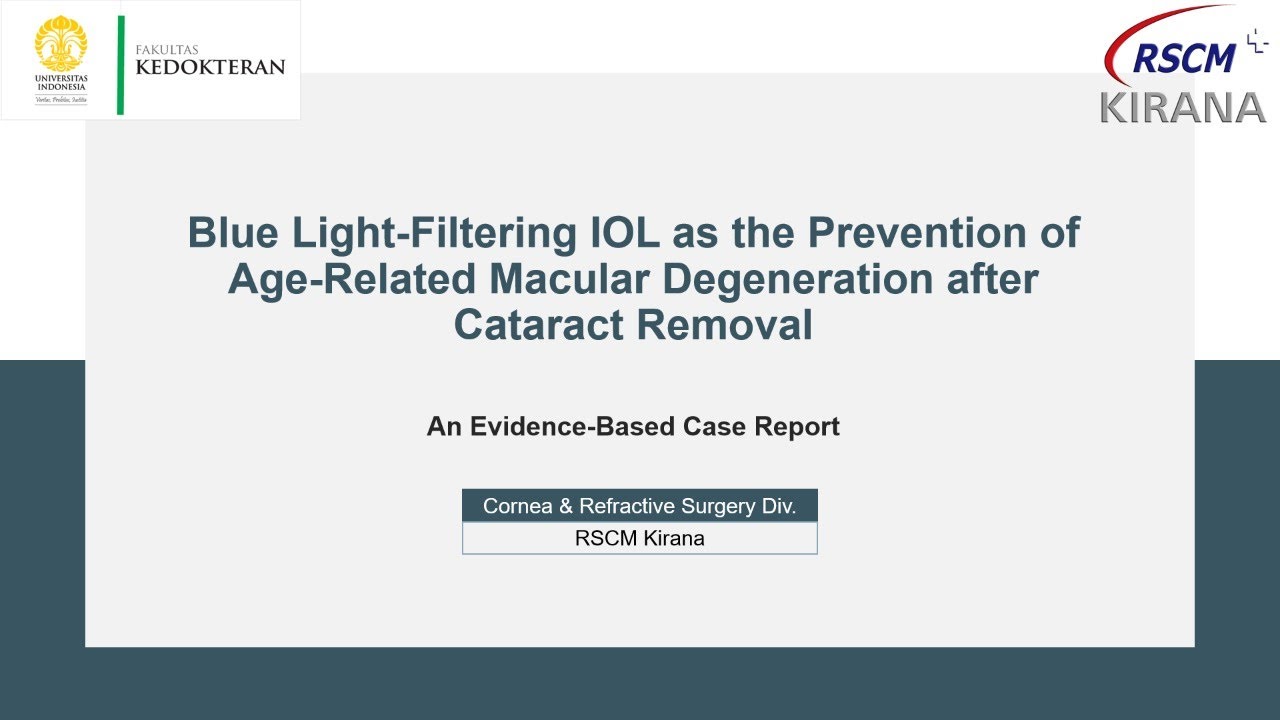 Blue Light Filtering IOL as Prevention of Age-related Macular ...