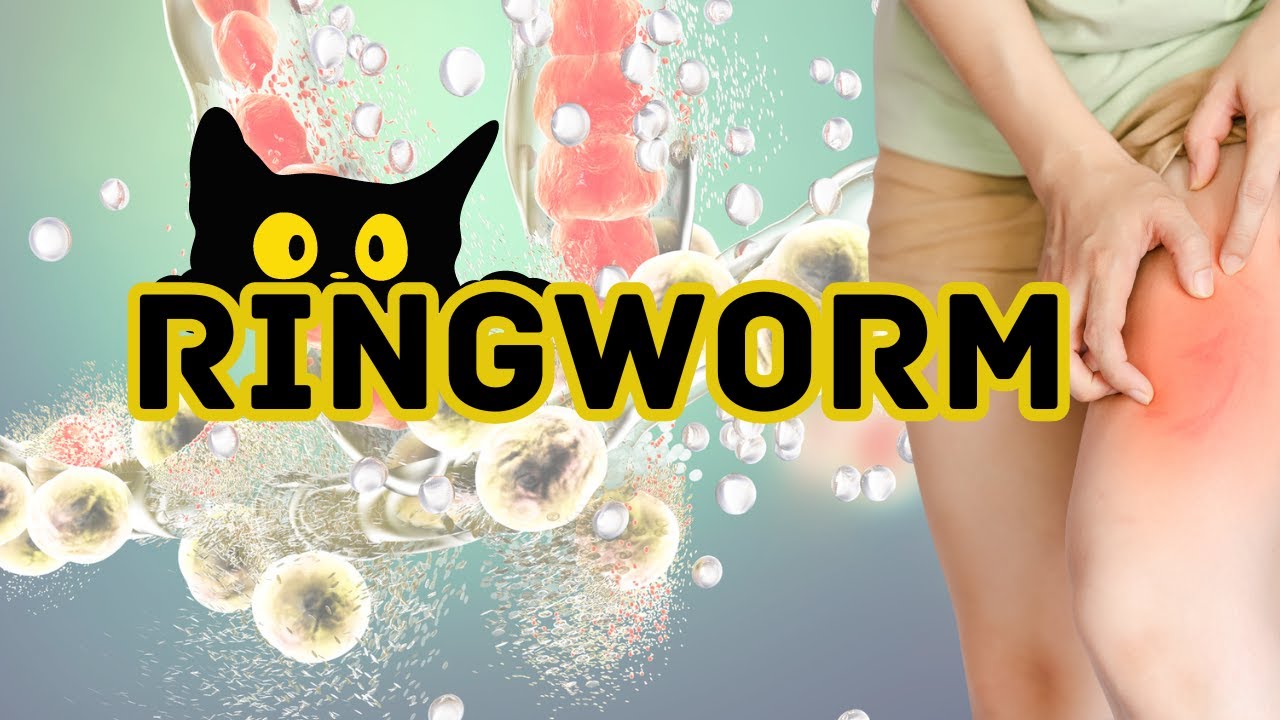 When Ringworm Finds You & Your Cat(s) - Stay Calm - YouTube