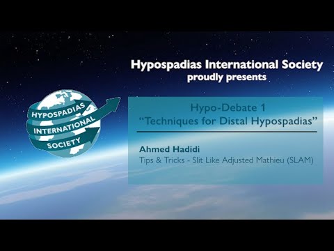 HIS Hypo-Debate 1: Techniques for Distal Hypospadias Ahmed Hadidi: Slit ...