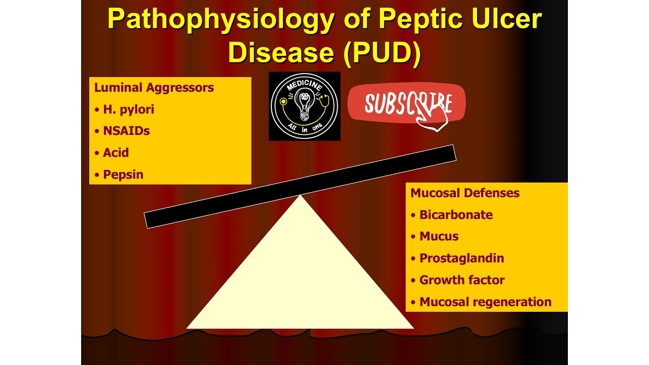 Pathophysiology of Peptic Acid Ulcer Disease - Pharmacology ...