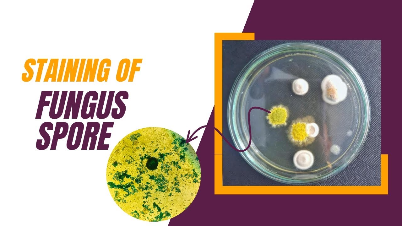 Staining of fungal spore by lactophenol cotton blue ||VLOG 2 😊 - YouTube