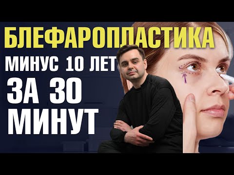 Блефаропластика верхних и нижних век | Реабилитация после пластики век. Доктор Золотов Сергей