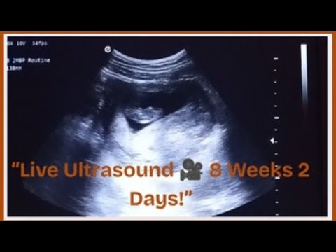 "8 Weeks 2 Days Pregnant: See Your Baby's First Movements!" - YouTube