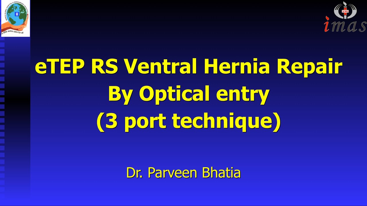 eTEP RS Ventral Hernia Repair by Optical entry & 3 Port | Step by step ...