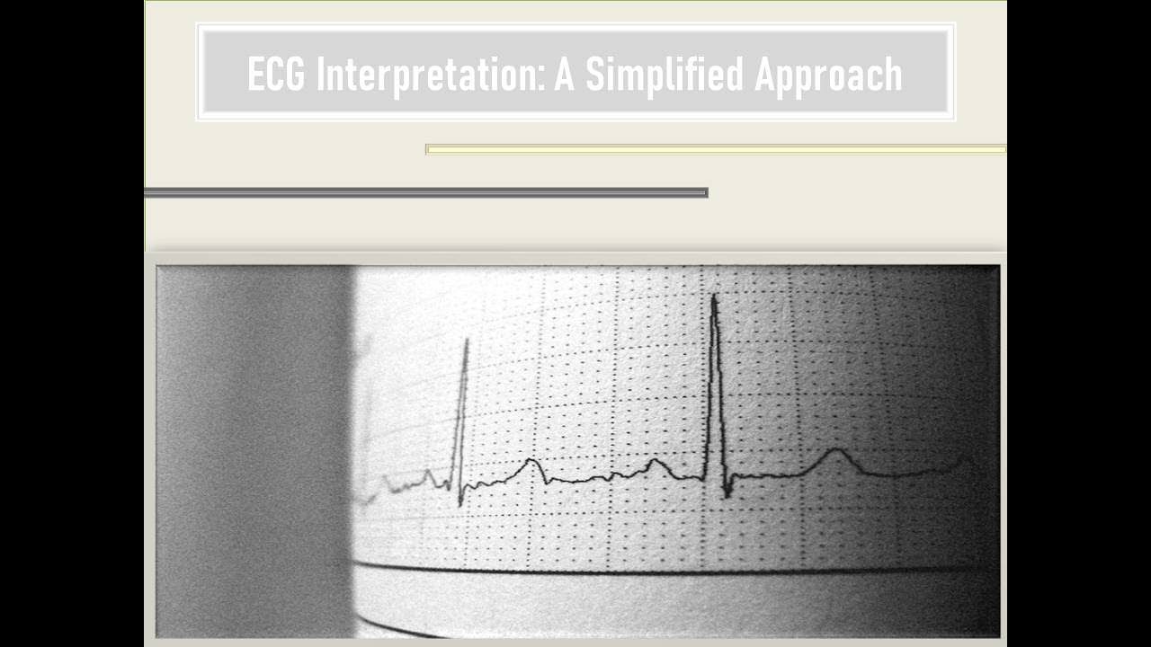 ECG Simplified: A Clear and Comprehensive Approach to Interpretation ...