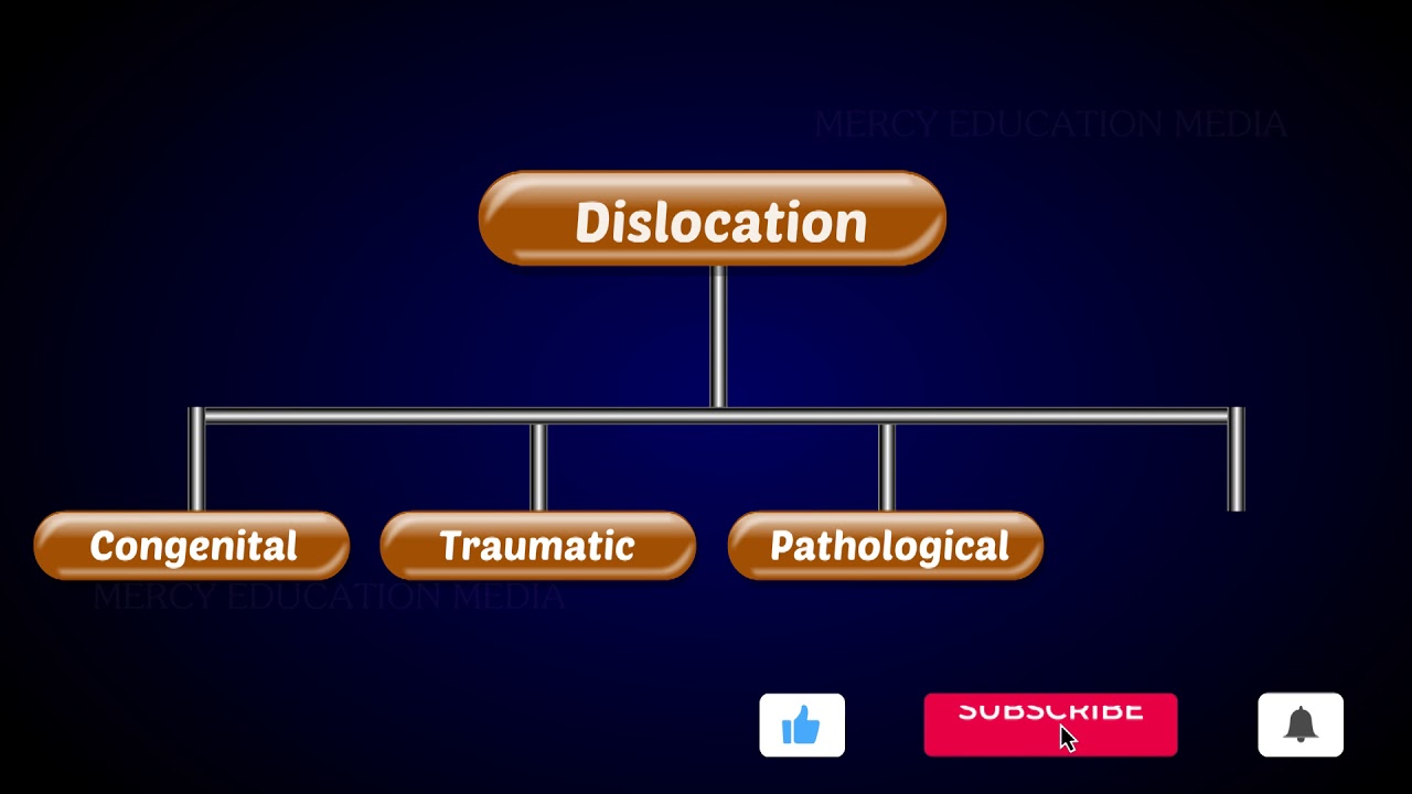 Dislocation of Joints | Types of Dislocation - YouTube