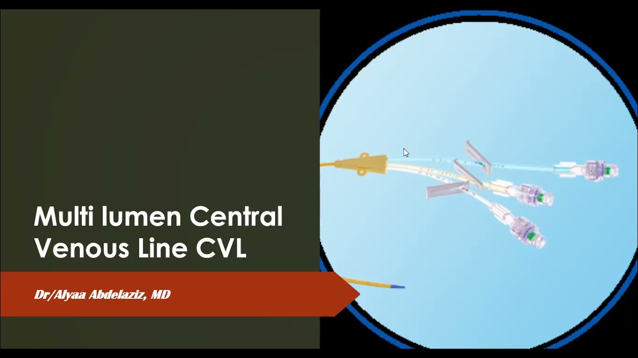 Multi-lumen Central Venous Catheter - YouTube