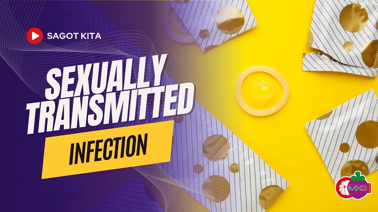 Maliban sa HIV anu-ano pa ang mga sexually transmitted infections ...