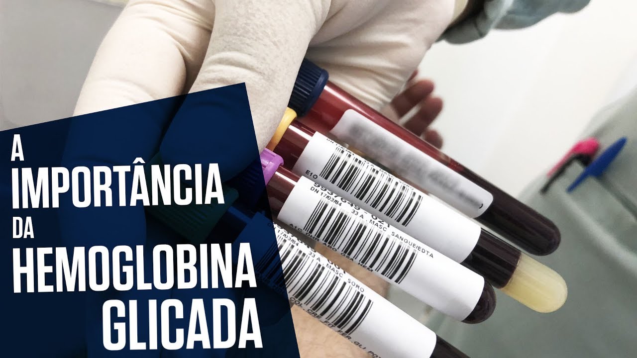 HEMOGLOBINA GLICADA – UM EXAME FUNDAMENTAL PARA SABER COMO ANDA O ...