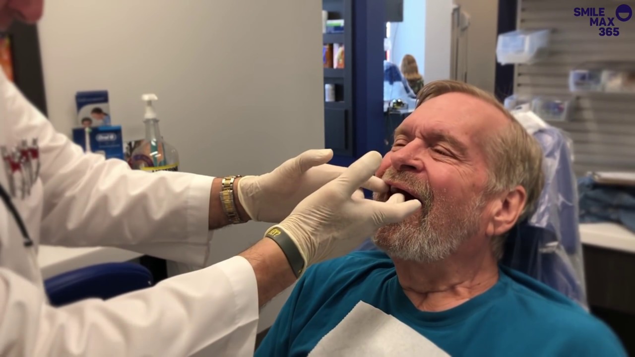 Dental Implant Post op Dentures YouTube dental-implant-post-op-dentures-youtube