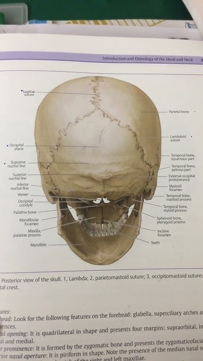 Lambda, Parietomastoid suture, Occipitomastoid suture, external ...