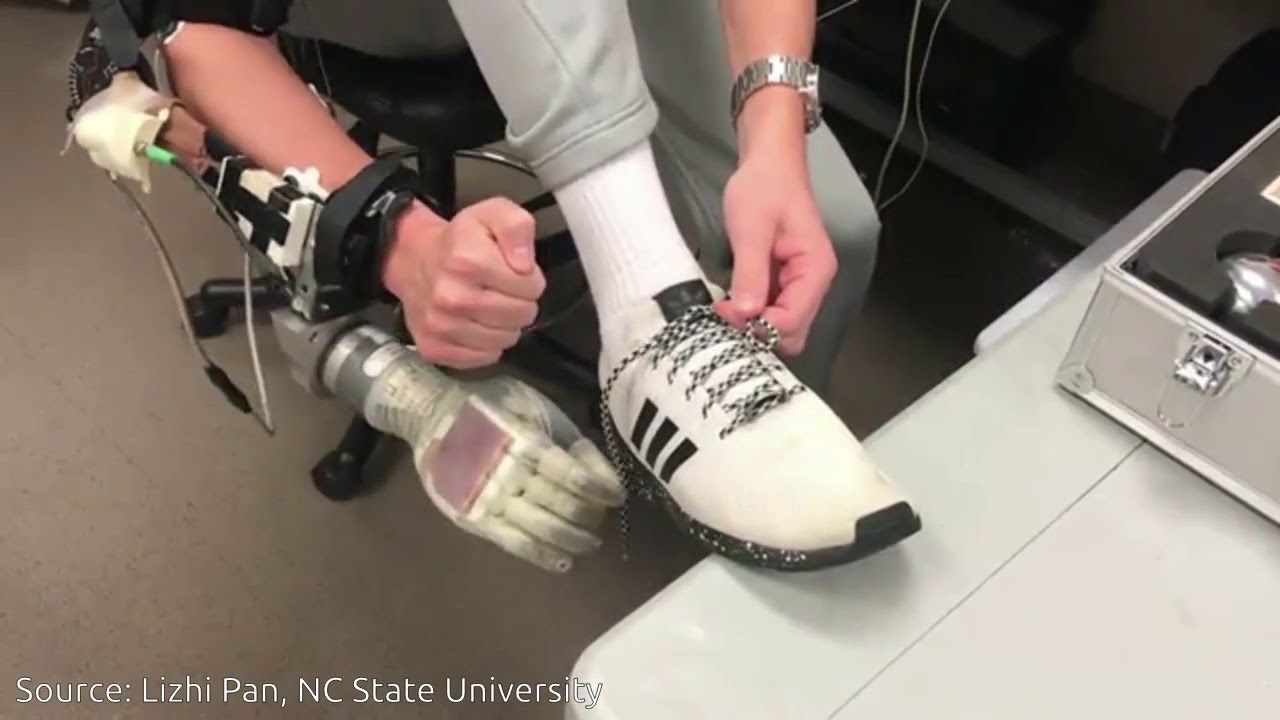 Use of Prosthetic Hands becomes Easier with New Technology - YouTube