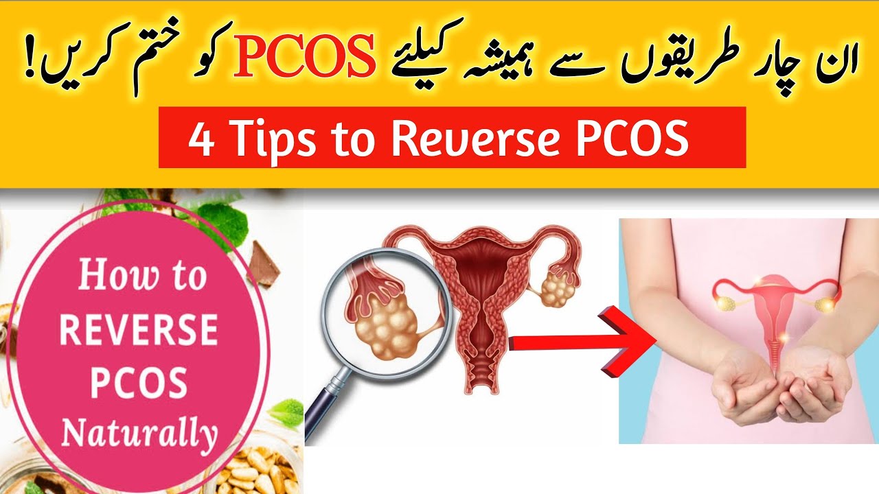 4 Tips to Reverse PCOS Naturally | How to cure PCOS naturally at home ...