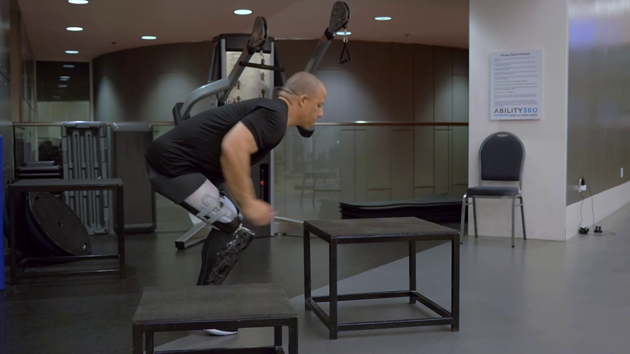 Socket less Socket™ cX - Improved Control | Martin Bionics Clinical ...