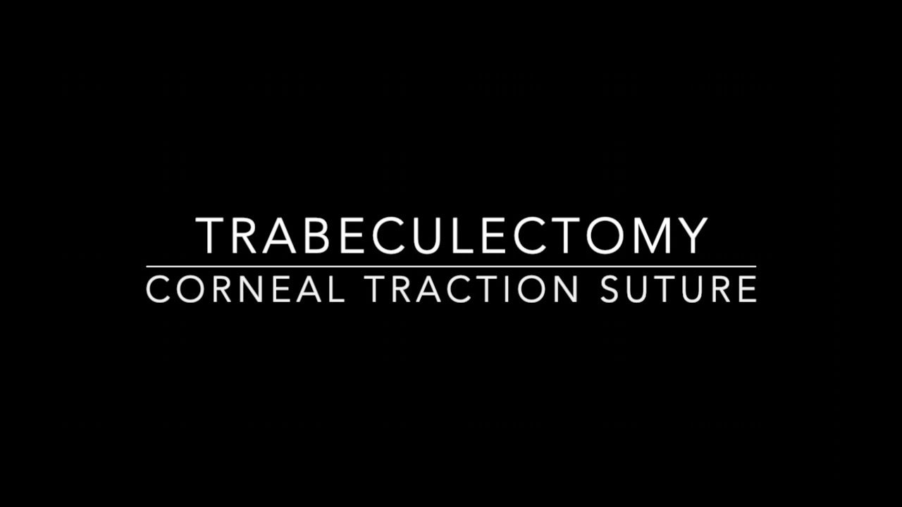 corneal traction suture - trabeculectomy - YouTube