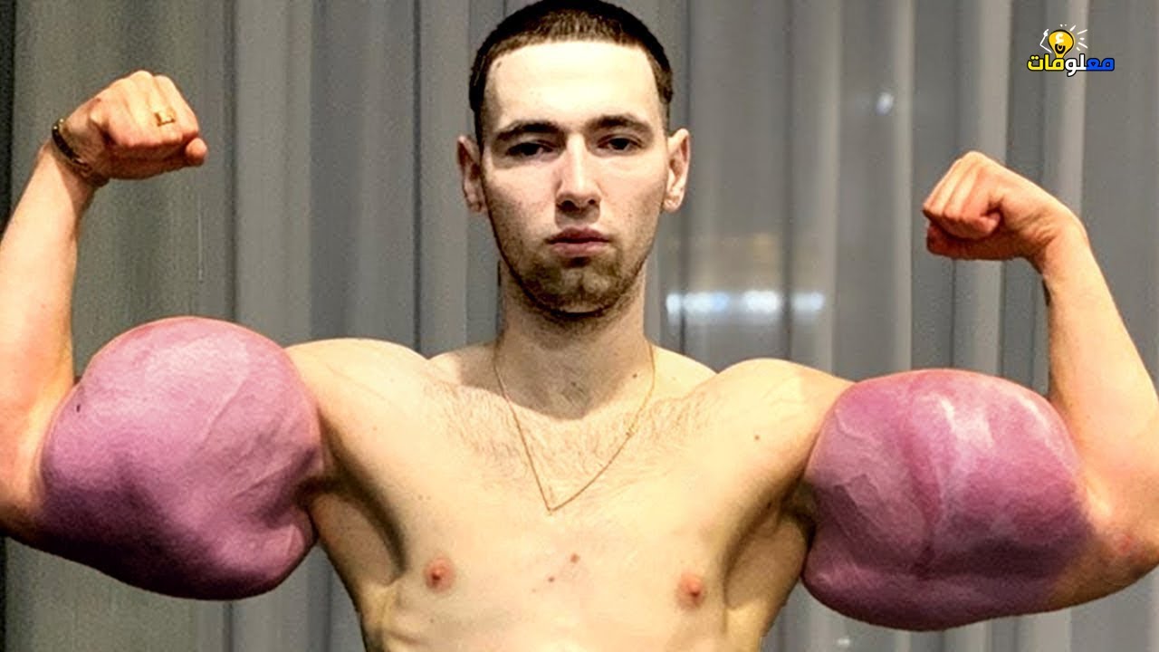 أغرب لاعبي كمال الأجسام يمتلكون عضلات ضخمة لكنها مزيفة - YouTube