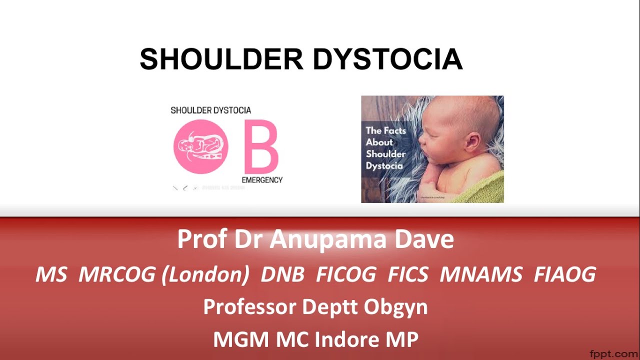 Obstetric Emergency - Shoulder Dystocia - YouTube