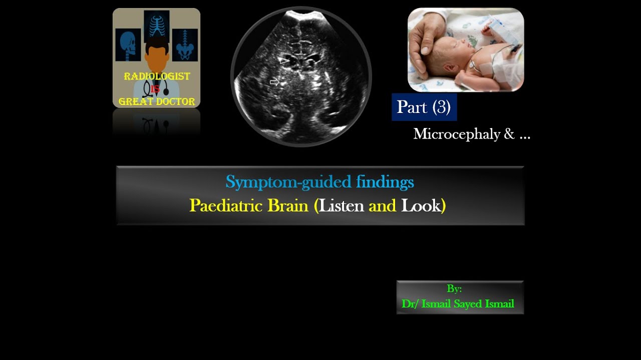 Sonographic Approach To Paediatric Brain (Part-3) - YouTube
