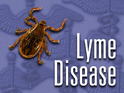LYME FILM - YouTube