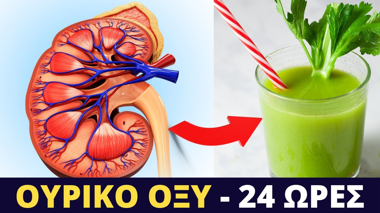 Πως Να Απομακρύνετε Το Ουρικό Οξύ Από Τα Νεφρά Σε 24 Ώρες! - YouTube