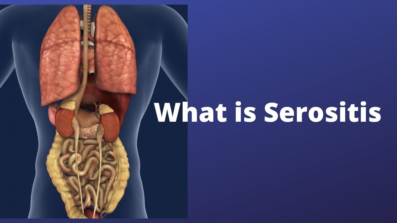 What is Serositis - YouTube