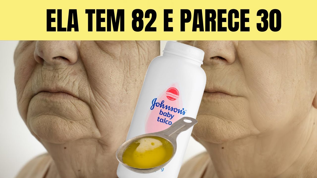 Bochecha Caida Antes E Depois - FDPLEARN