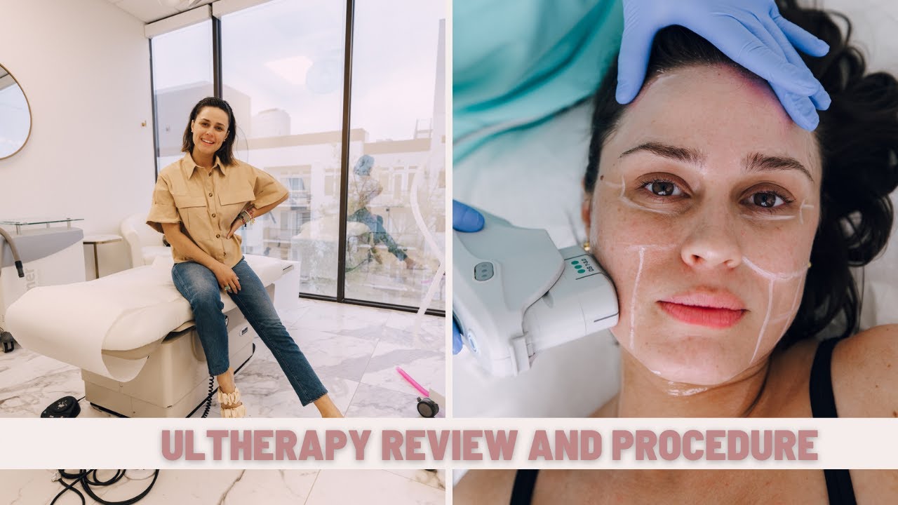Ultherapy Review and What the procedure is like - YouTube