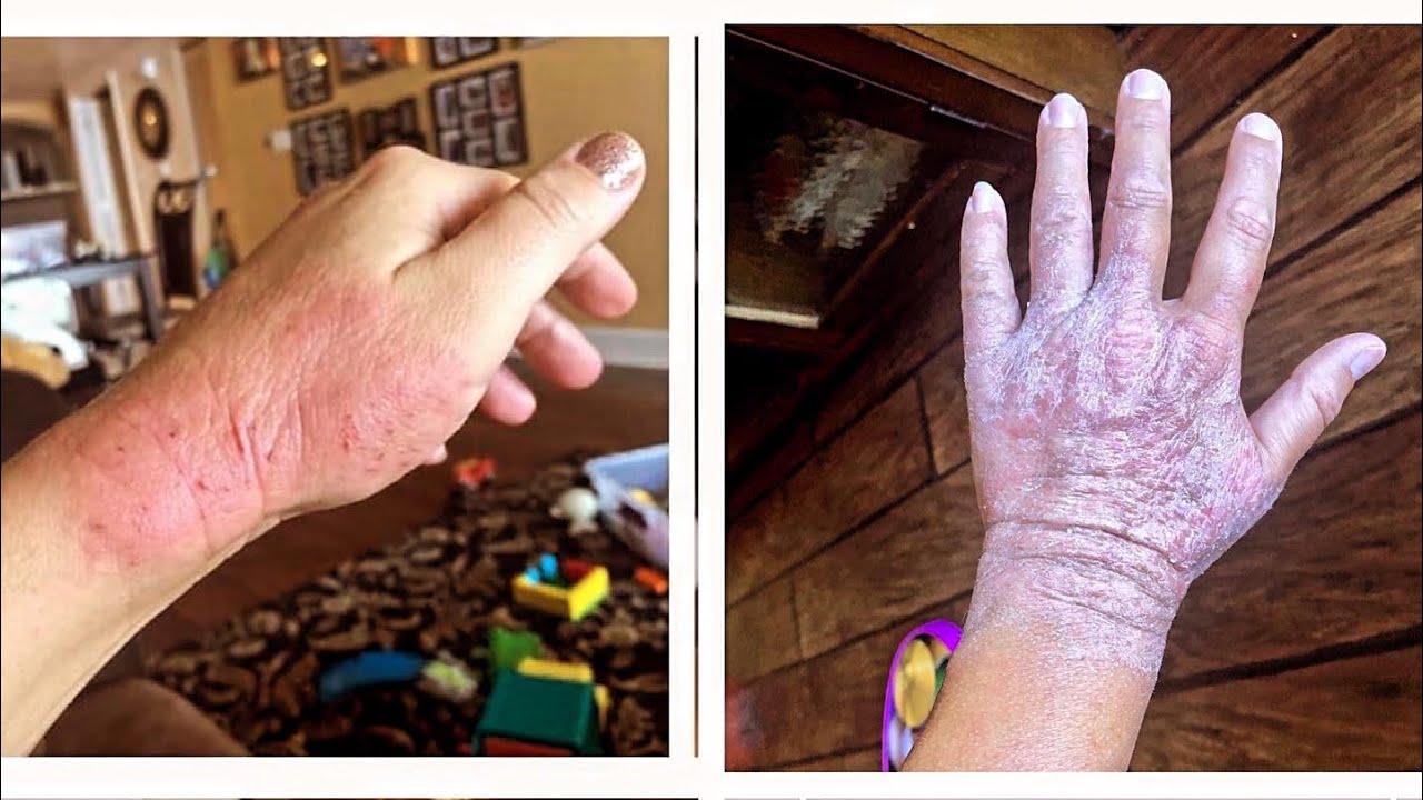 Restore and soothe your skin! Pink Healing Balm from Lemongrass Spa ...