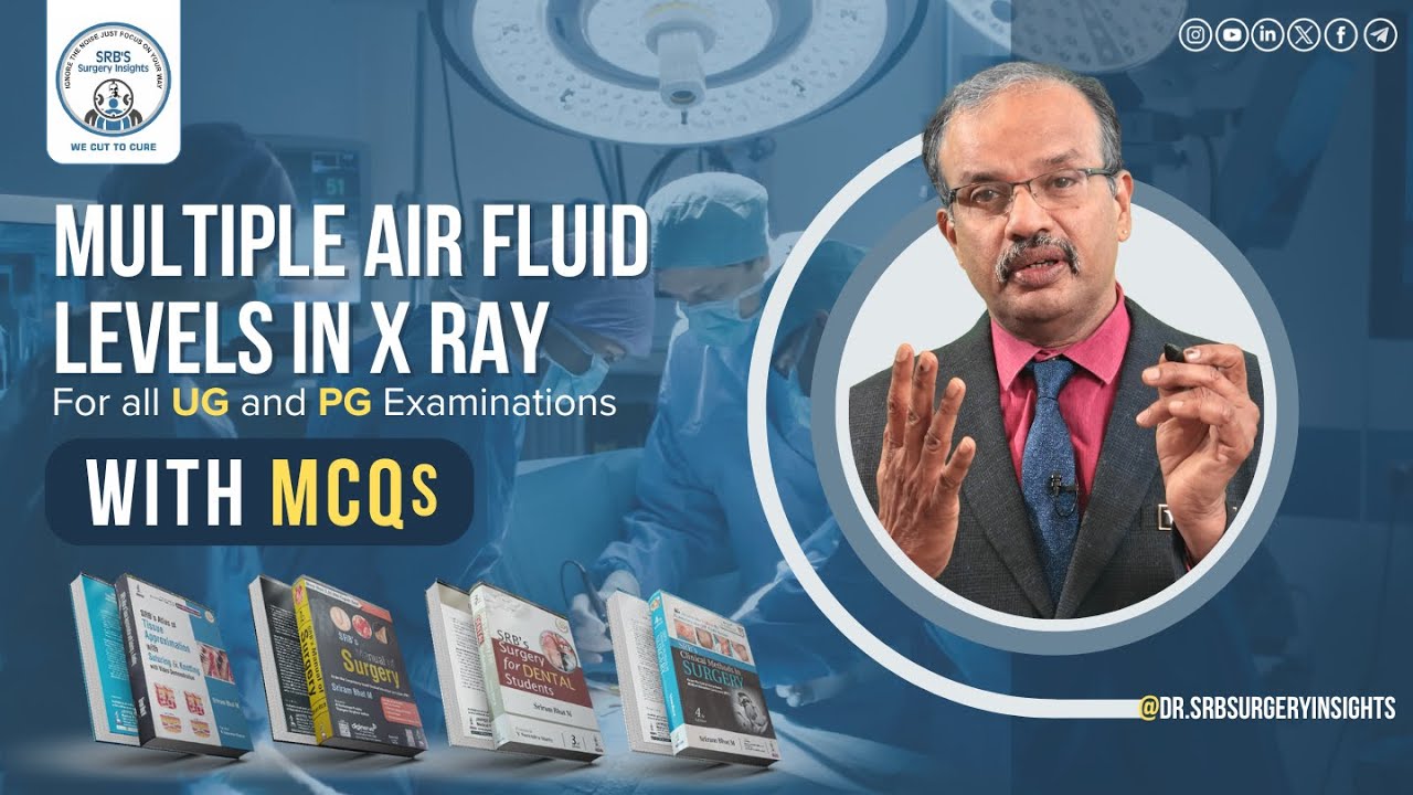 Multiple Air Fluid Levels in X- Ray by Dr. SRB | Dr. Srirama Bhat - YouTube