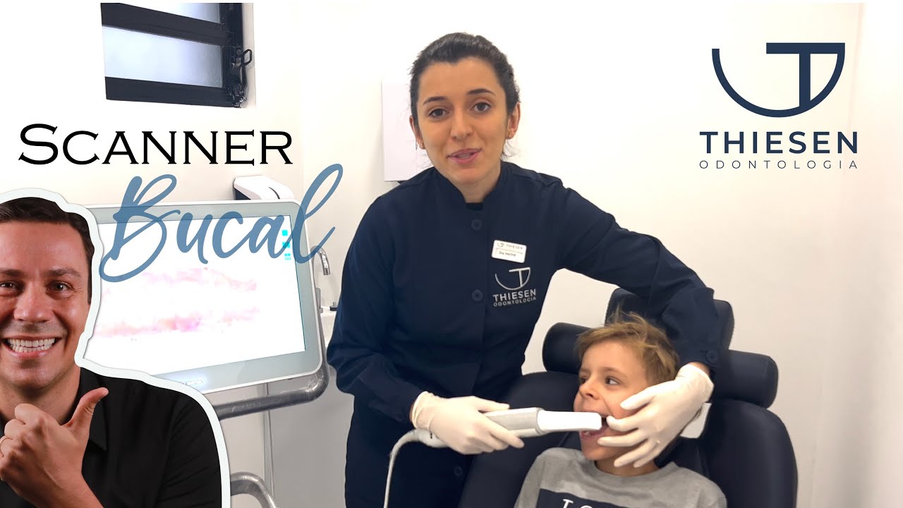 Escaneamento bucal com scanner 3D em Florianópolis - YouTube