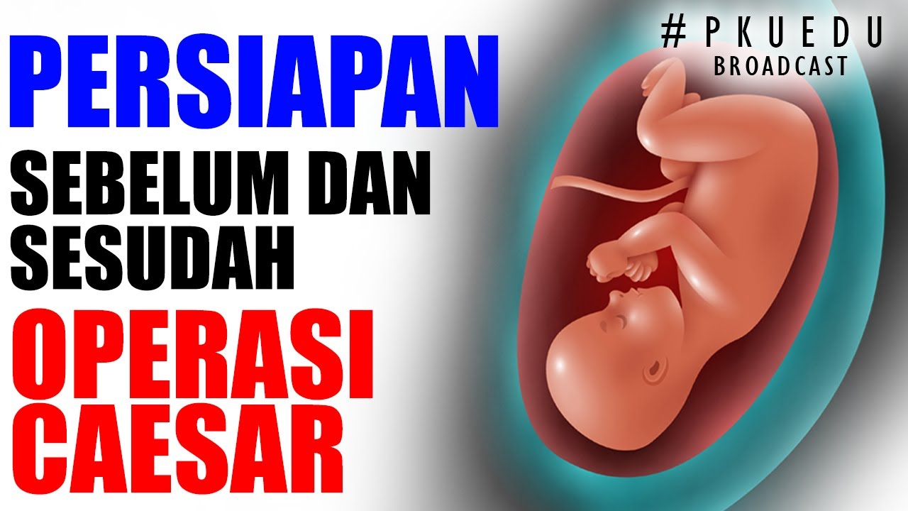 Persiapan Operasi Caesar | #PKUEDU - YouTube