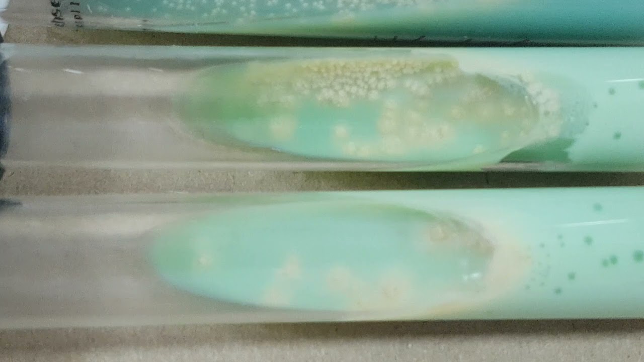 Löwenstein Jensen culture positive# Mycobacterium tuberculosis complex ...